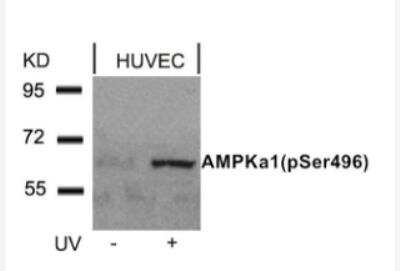 AMPK alpha 1 [p Ser496] Antibody (NB100-81784): Novus Biologicals